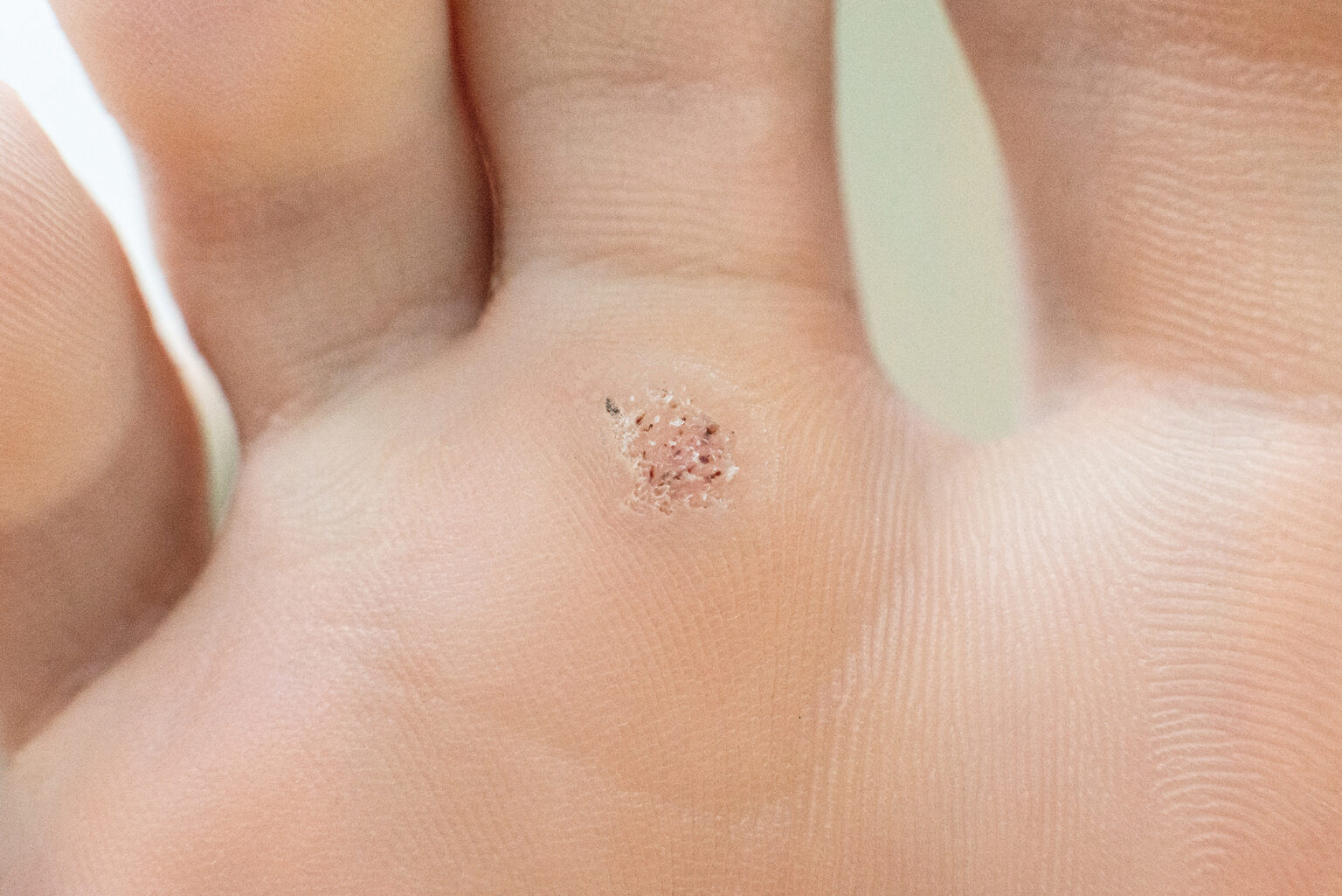 Fodvorter – Bang Brix